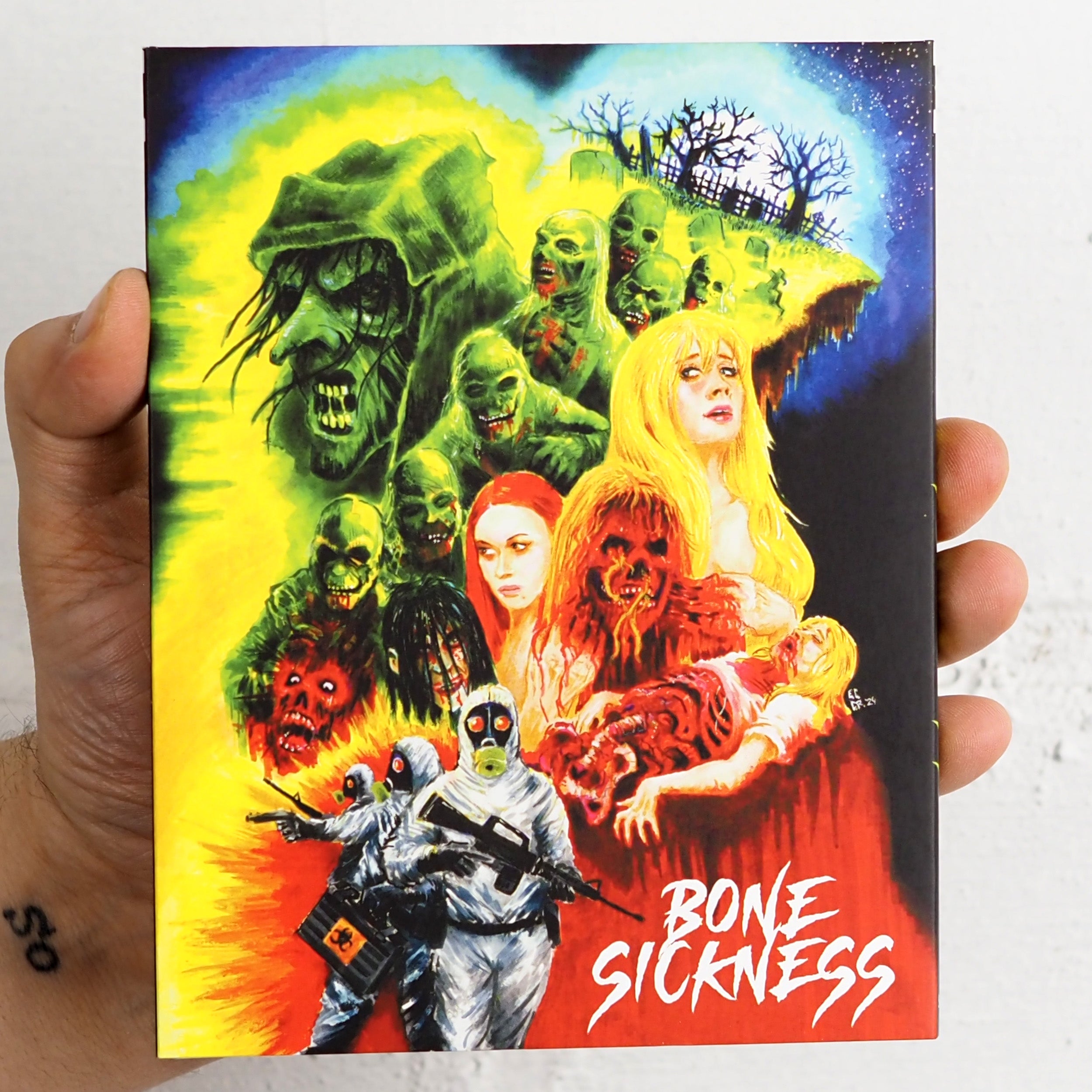 Bone Sickness – Vinegar Syndrome