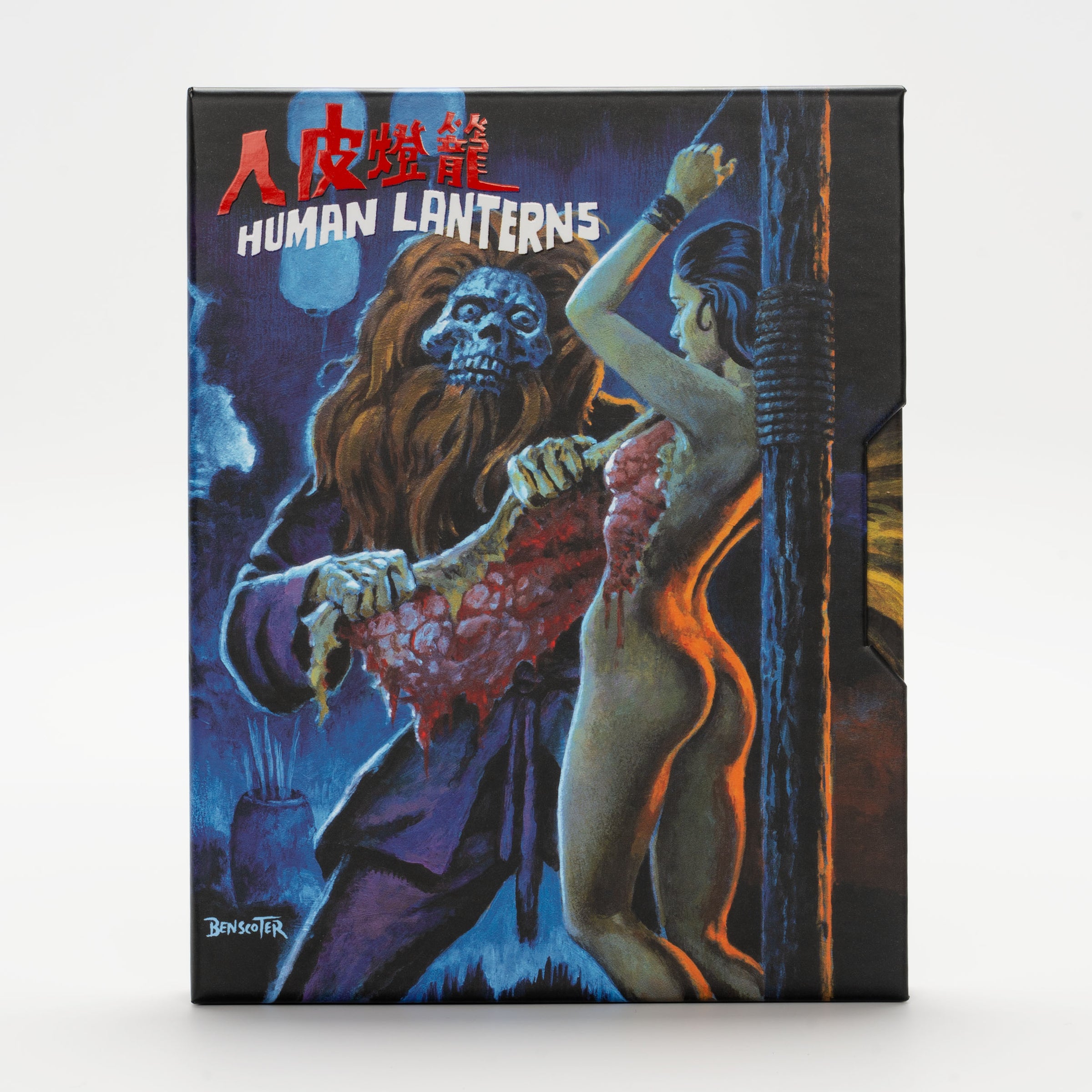 Human Lanterns – Vinegar Syndrome